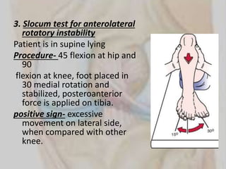 Posterior cruciate liagment.pptx