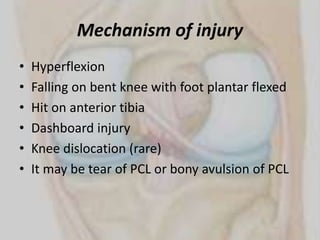 Posterior cruciate liagment.pptx