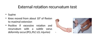 Posterior cruciate ligament injuries.pptx