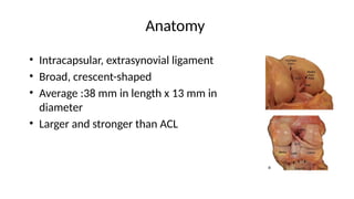Posterior cruciate ligament injuries.pptx
