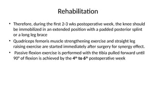 Posterior cruciate ligament injuries.pptx