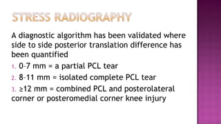 posterior cruciate ligament injury.ppt. . | PPT