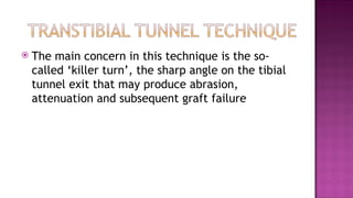 posterior cruciate ligament injury.ppt. . | PPT