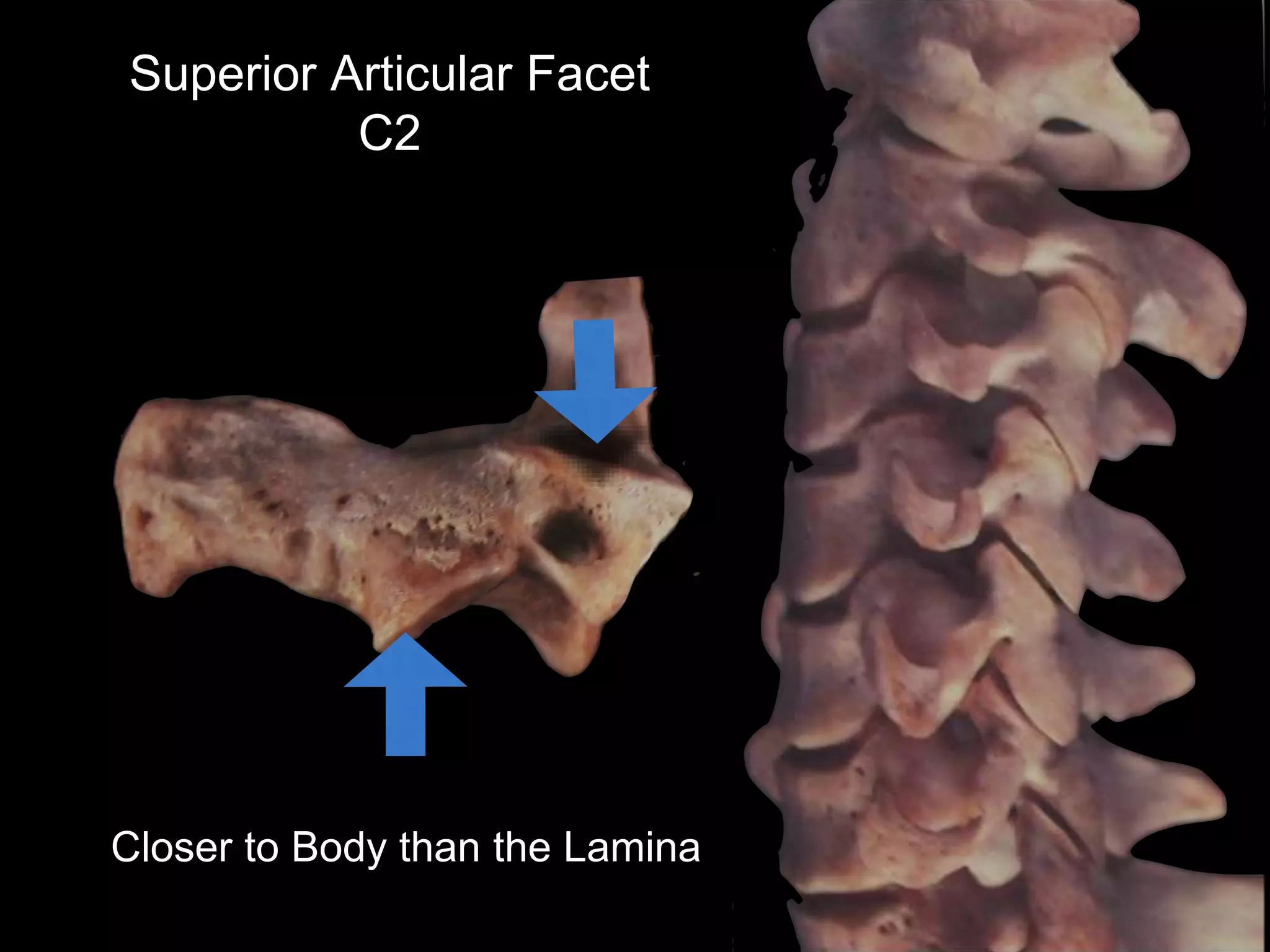 Applied surgical anatomy of the craniovertebral spine | PPTX