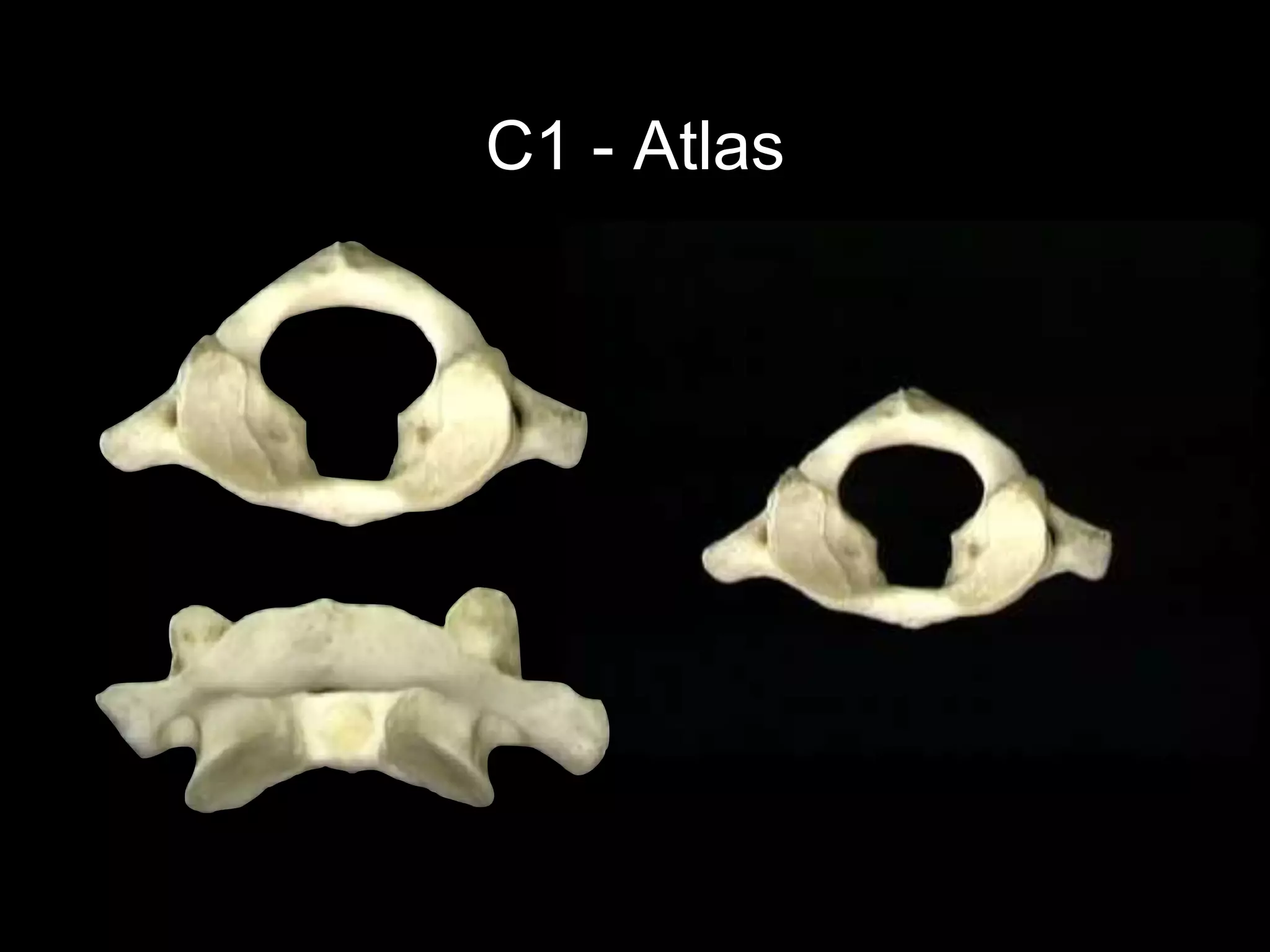 Applied surgical anatomy of the craniovertebral spine | PPTX