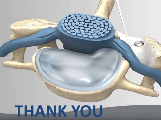 Posterior foraminotomy for cervical disc herniation | PPTX | Death ...