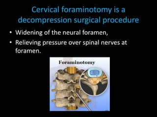 Posterior foraminotomy for cervical disc herniation | PPTX