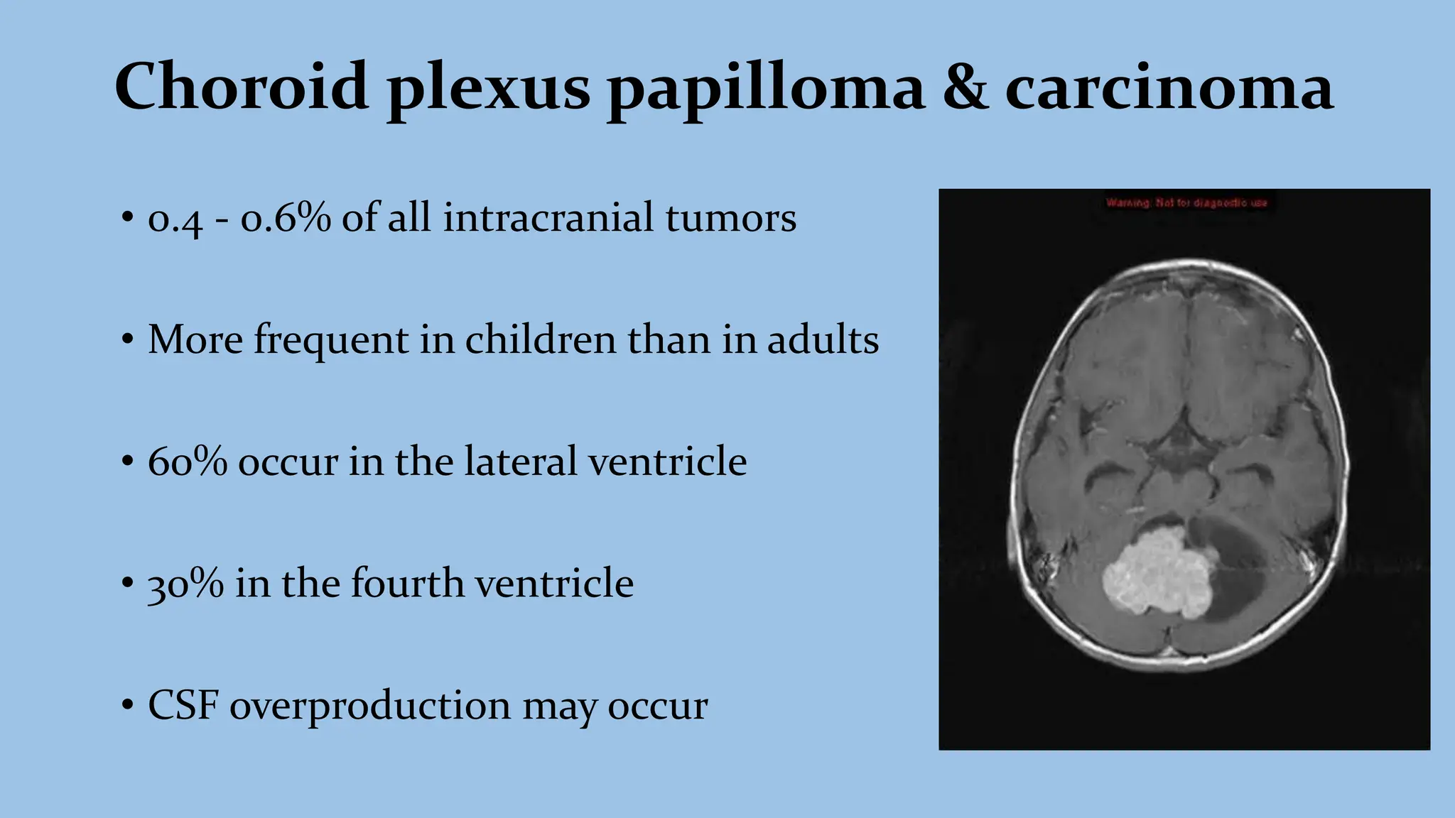 Posterior Fossa Anatomy And Tumors Of The Posterior Fossa Ppt