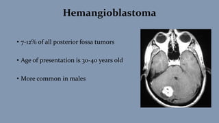 Posterior Fossa Anatomy and Tumors of the Posterior Fossa | PPT