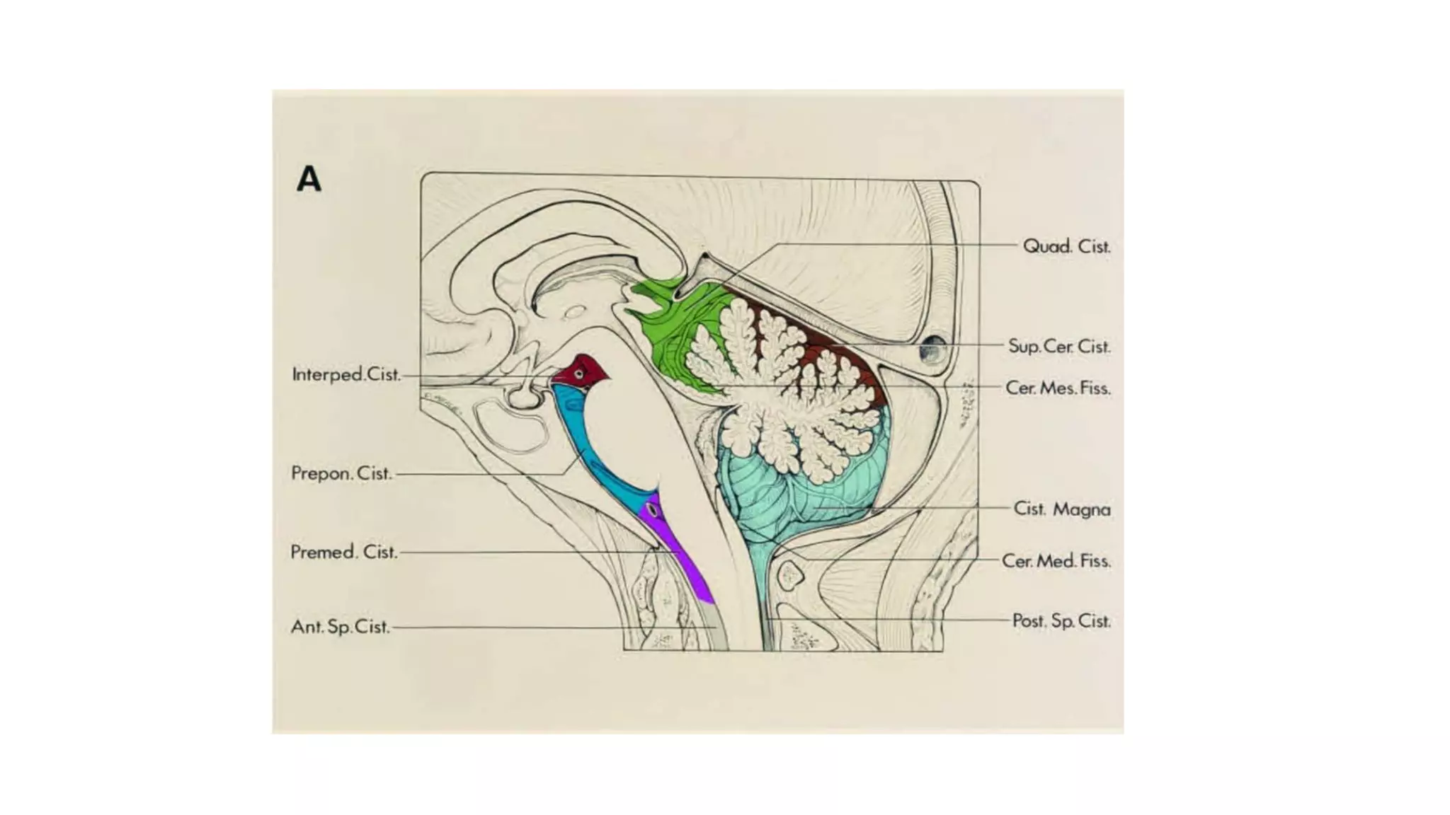 POSTERIOR FOSSA CISTERNS.pptx