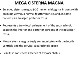 Mega Cisterna Magna Vs Arachnoid Cyst