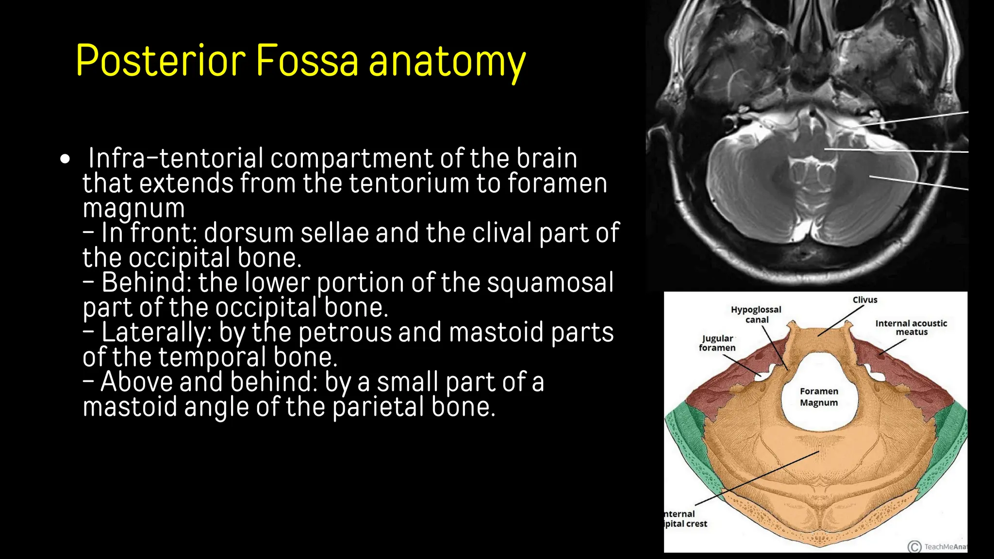 Posterior fossa tumours - Head and neck radiology pdf | PDF