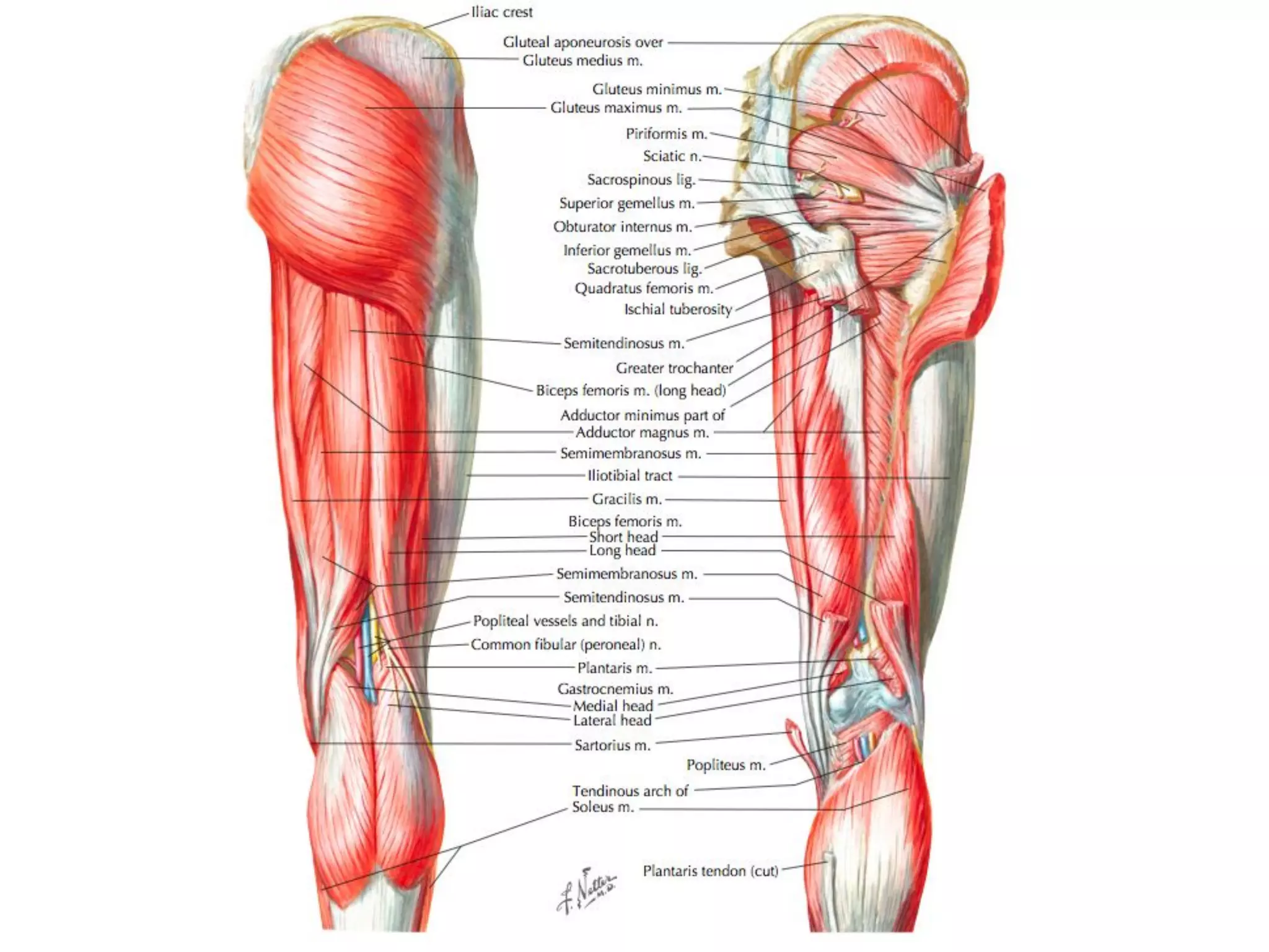 Posteriorhipdislocation | PDF
