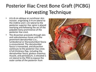 Posterior iliac crest bone graft | PPT