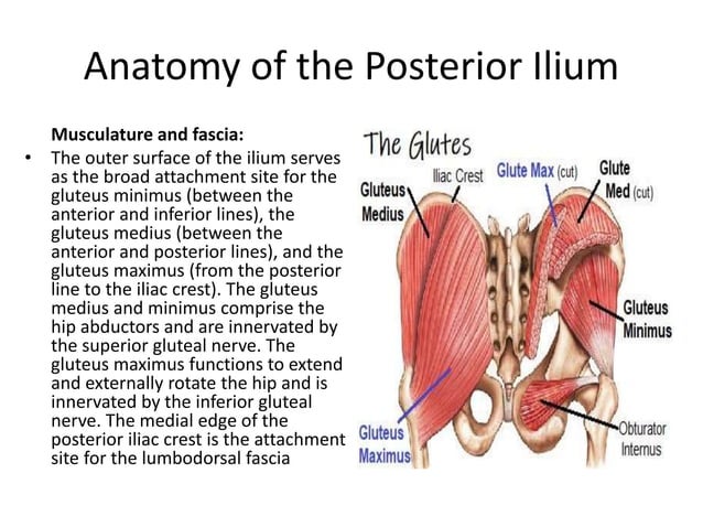 Posterior iliac crest bone graft
