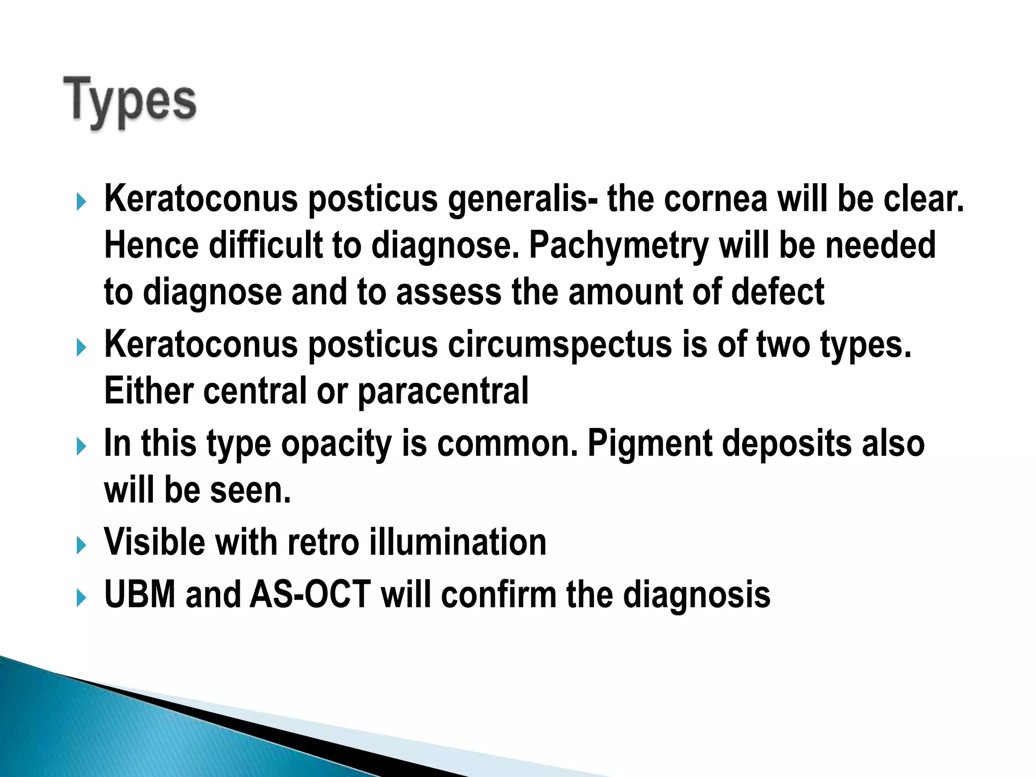 Posterior keratoconus | PPTX