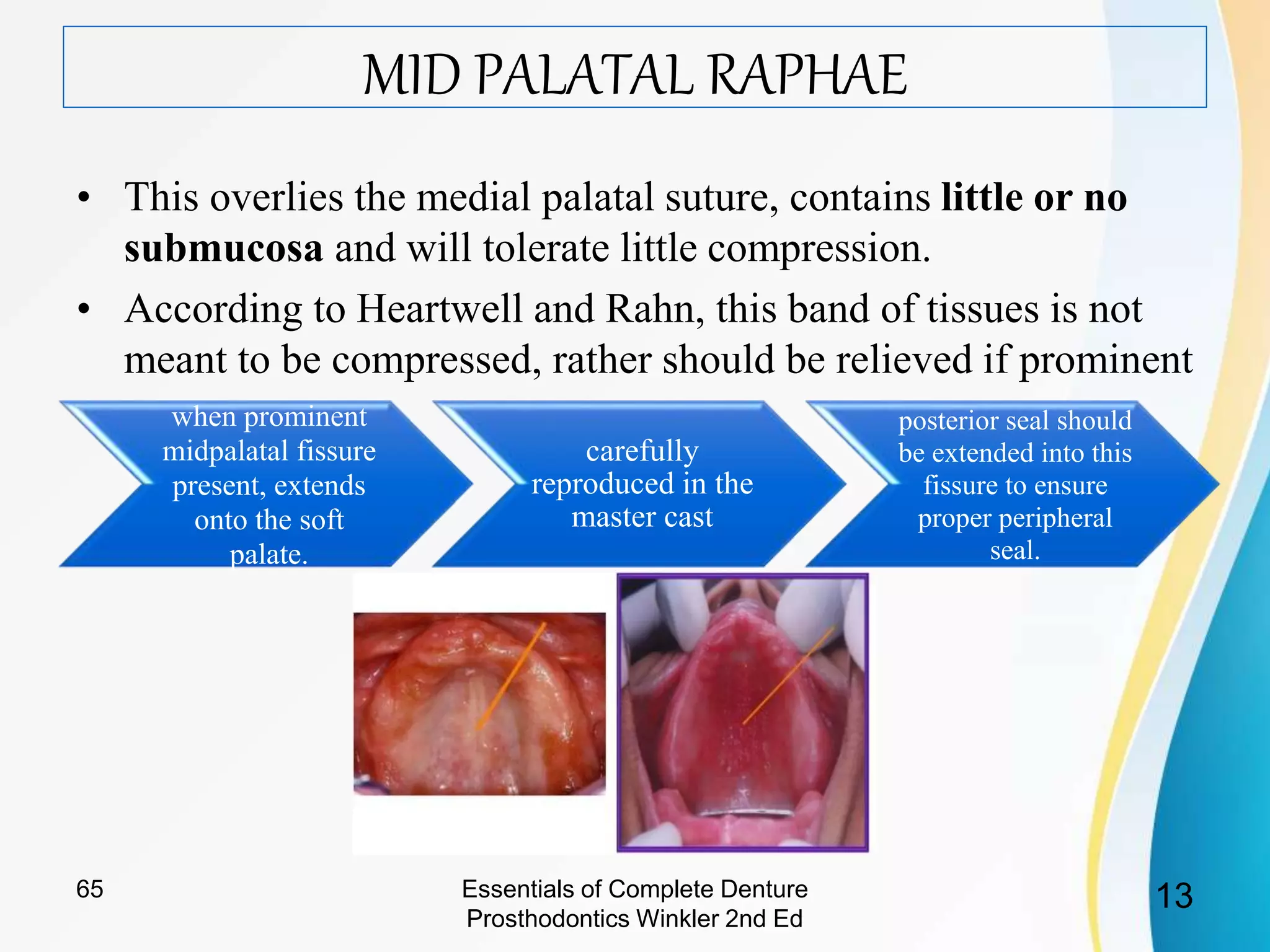 Posterior palatal seal | PPTX