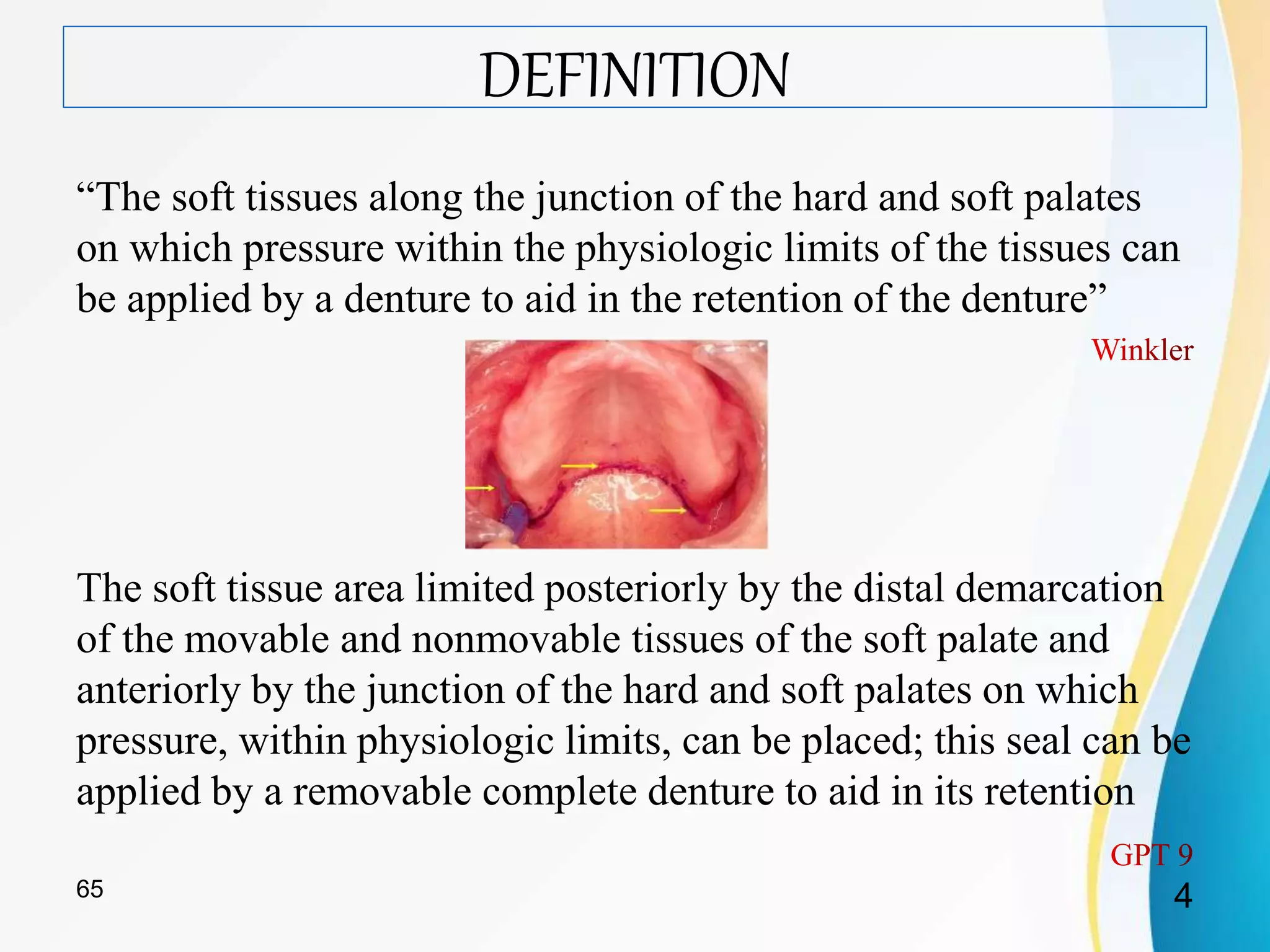 Posterior palatal seal | PPTX