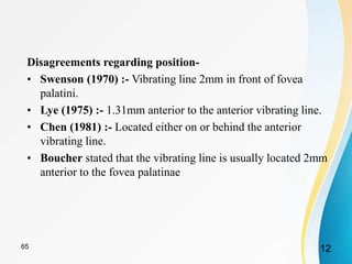 Fovea Palatini Vibrating Line