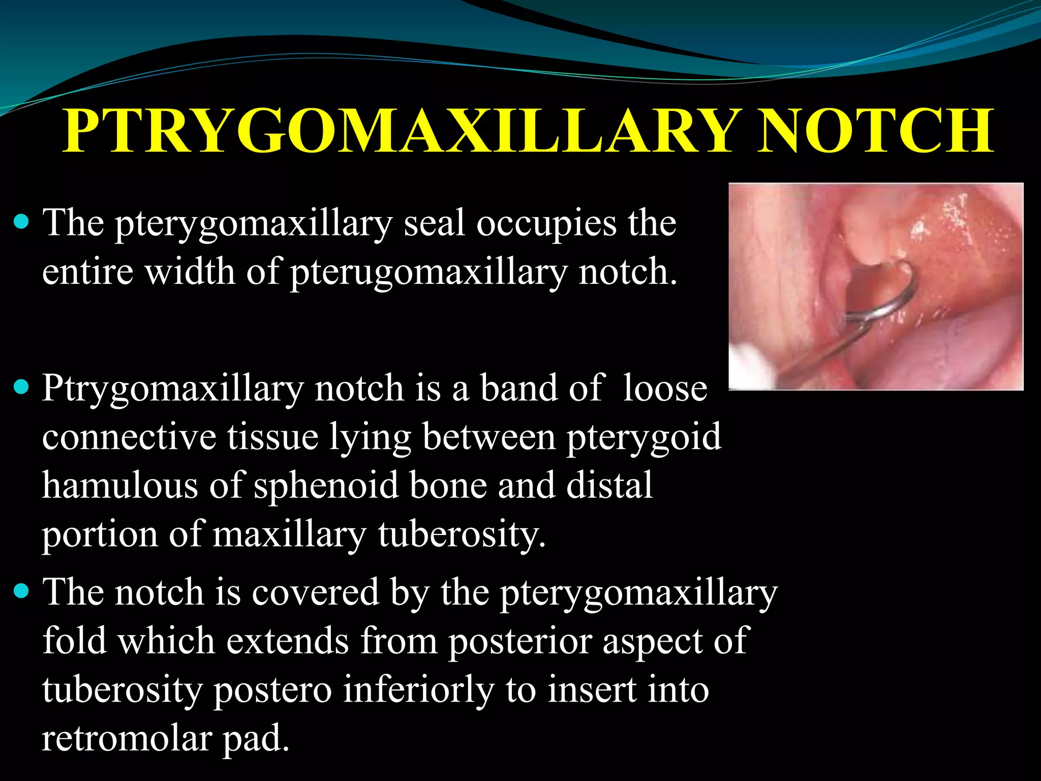 Posterior Palatal Seal_113550.pptx