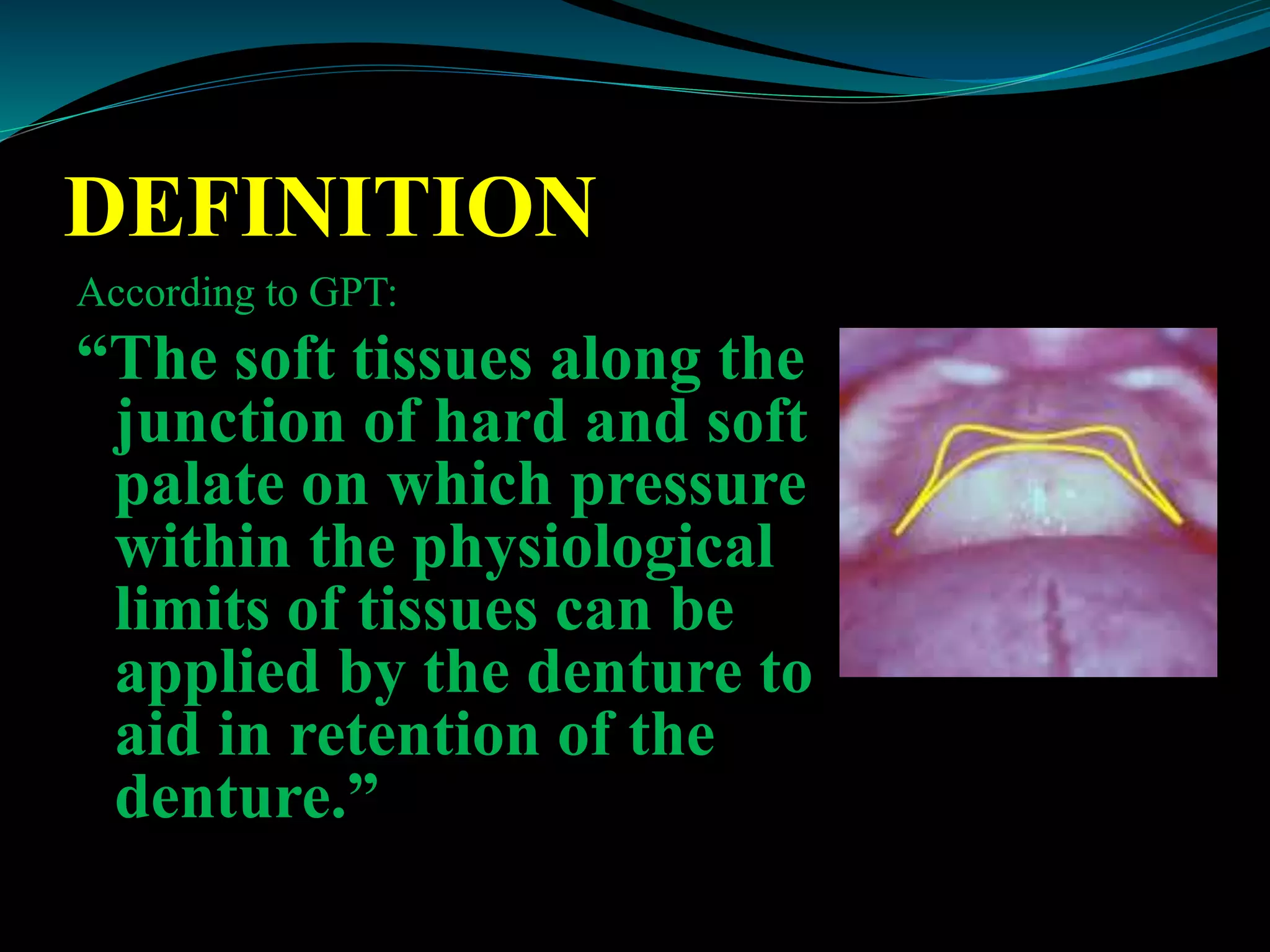 Posterior Palatal Seal_113550.pptx