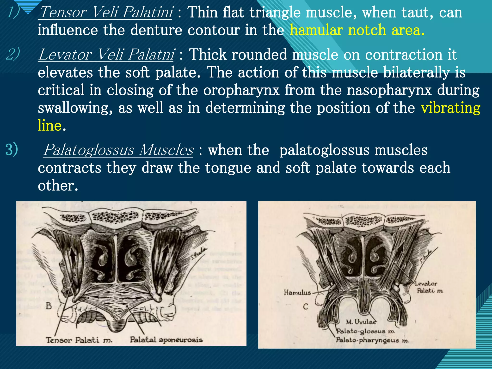 Posterior palatal seal | PPT