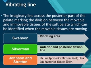 Posterior palatal seal | PPT