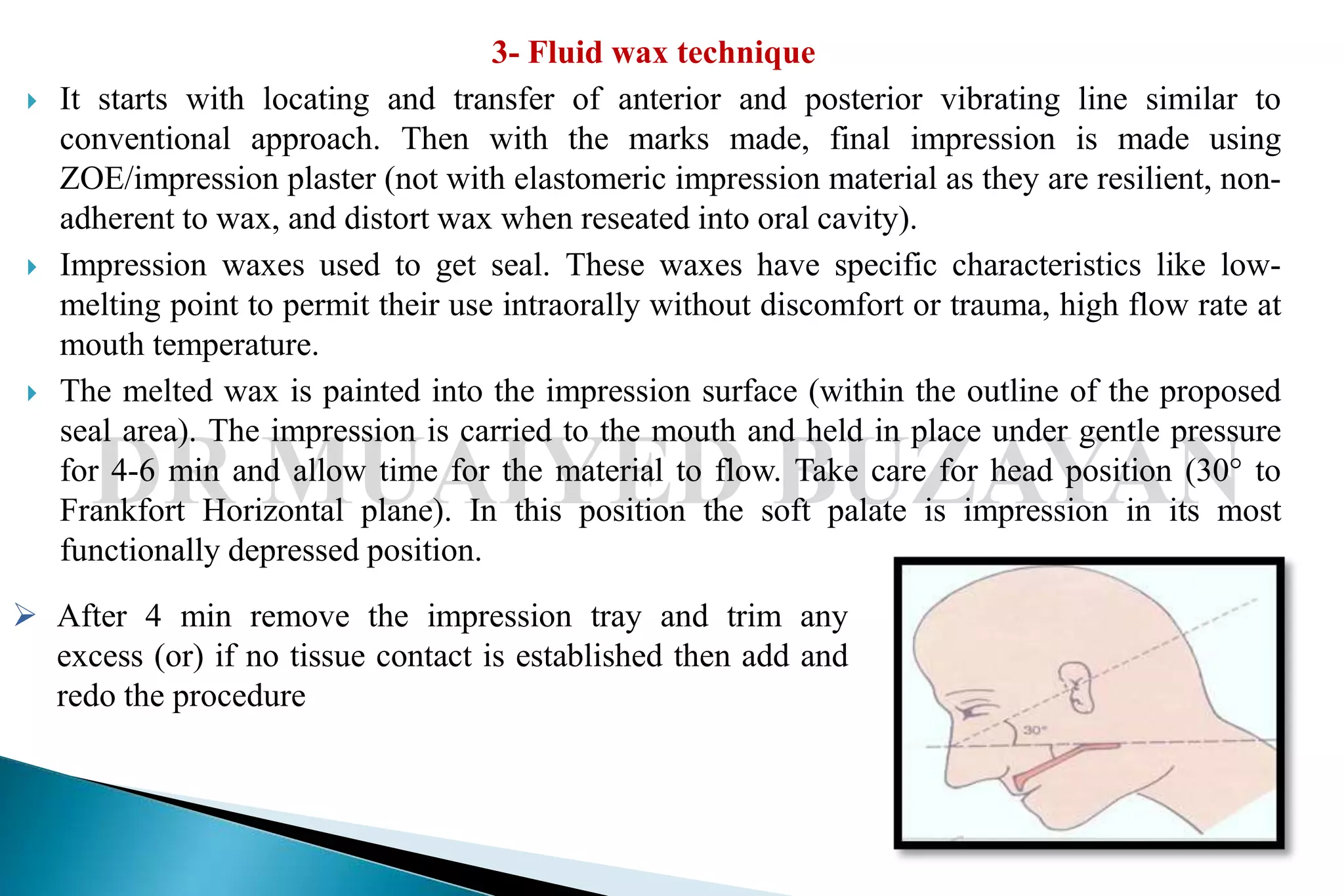 Posterior palatal seal 2nd yr | PPTX