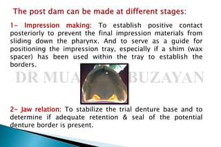 Posterior palatal seal 2nd yr | PPTX