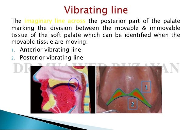 Posterior Oral Palate