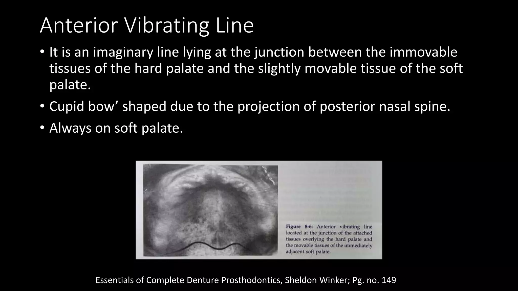 Posterior Palatal Seal | PPTX
