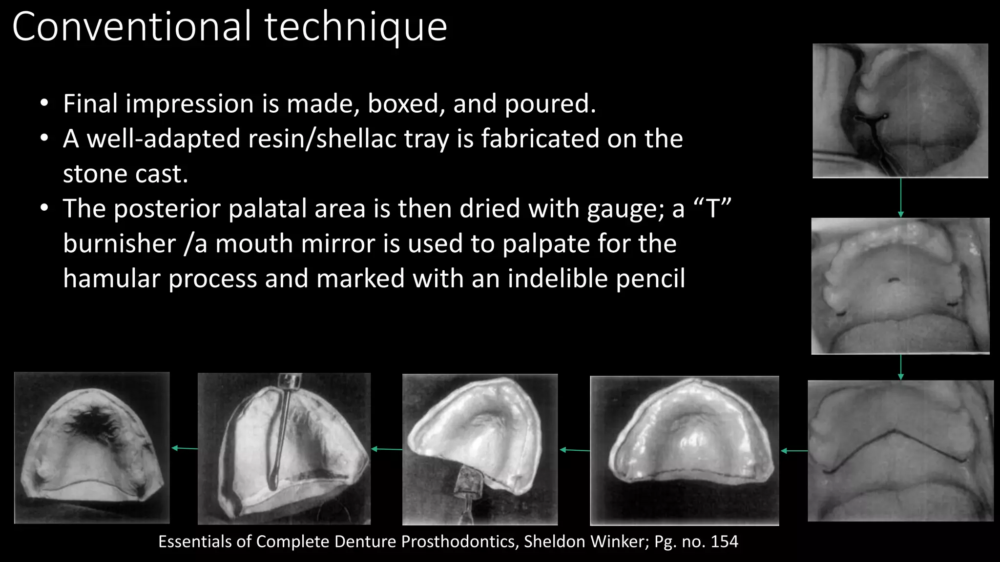 Posterior Palatal Seal | PPTX