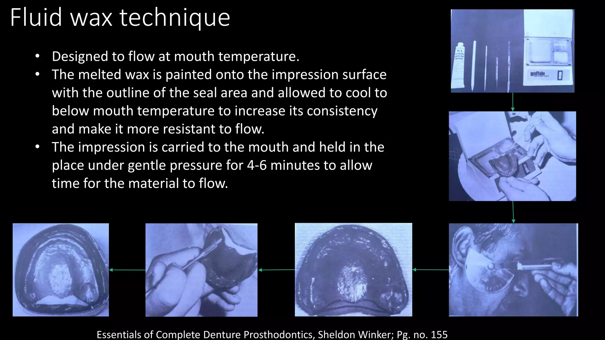 Posterior Palatal Seal | PPTX