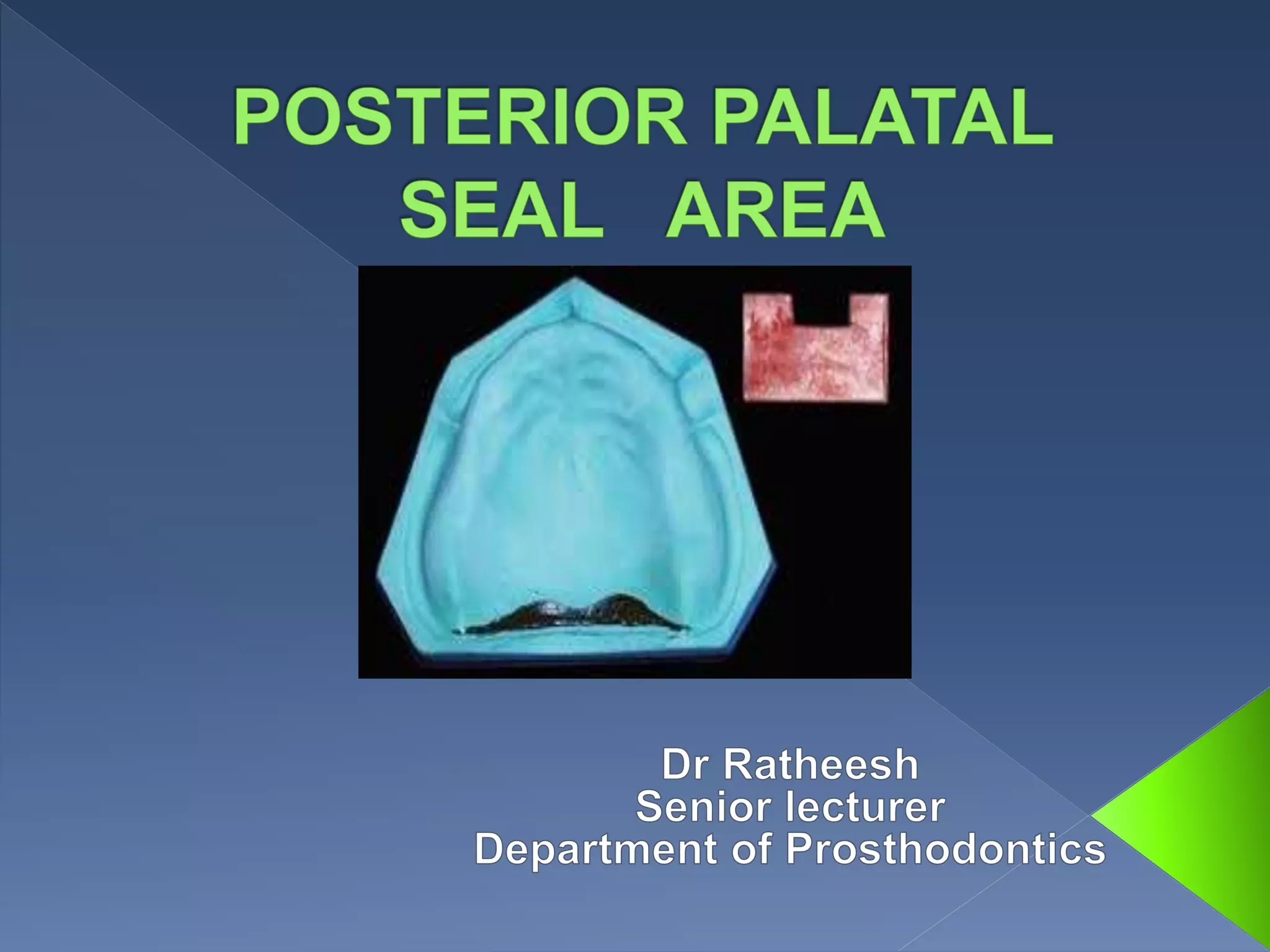 POSTERIOR PALATAL SEAL AREA.pptx