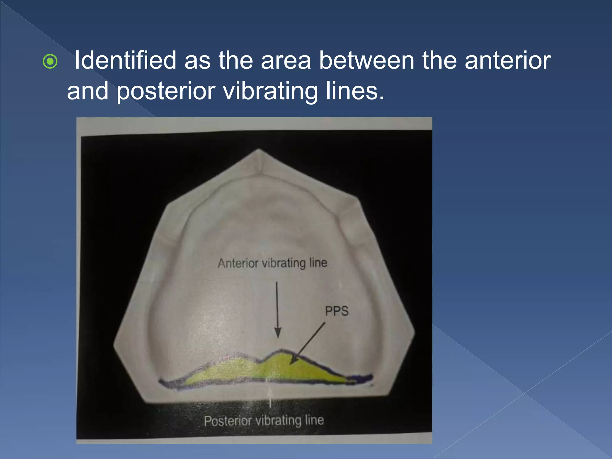 POSTERIOR PALATAL SEAL AREA.pptx