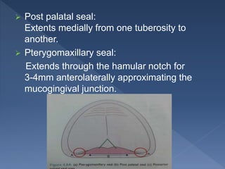 POSTERIOR PALATAL SEAL AREA.pptx