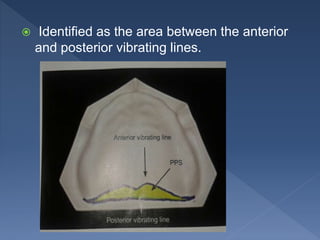 POSTERIOR PALATAL SEAL AREA.pptx