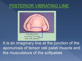 POSTERIOR PALATAL SEAL AREA.pptx