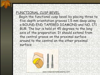 Posterior partial veneer crowns / dental implant courses by Indian ...