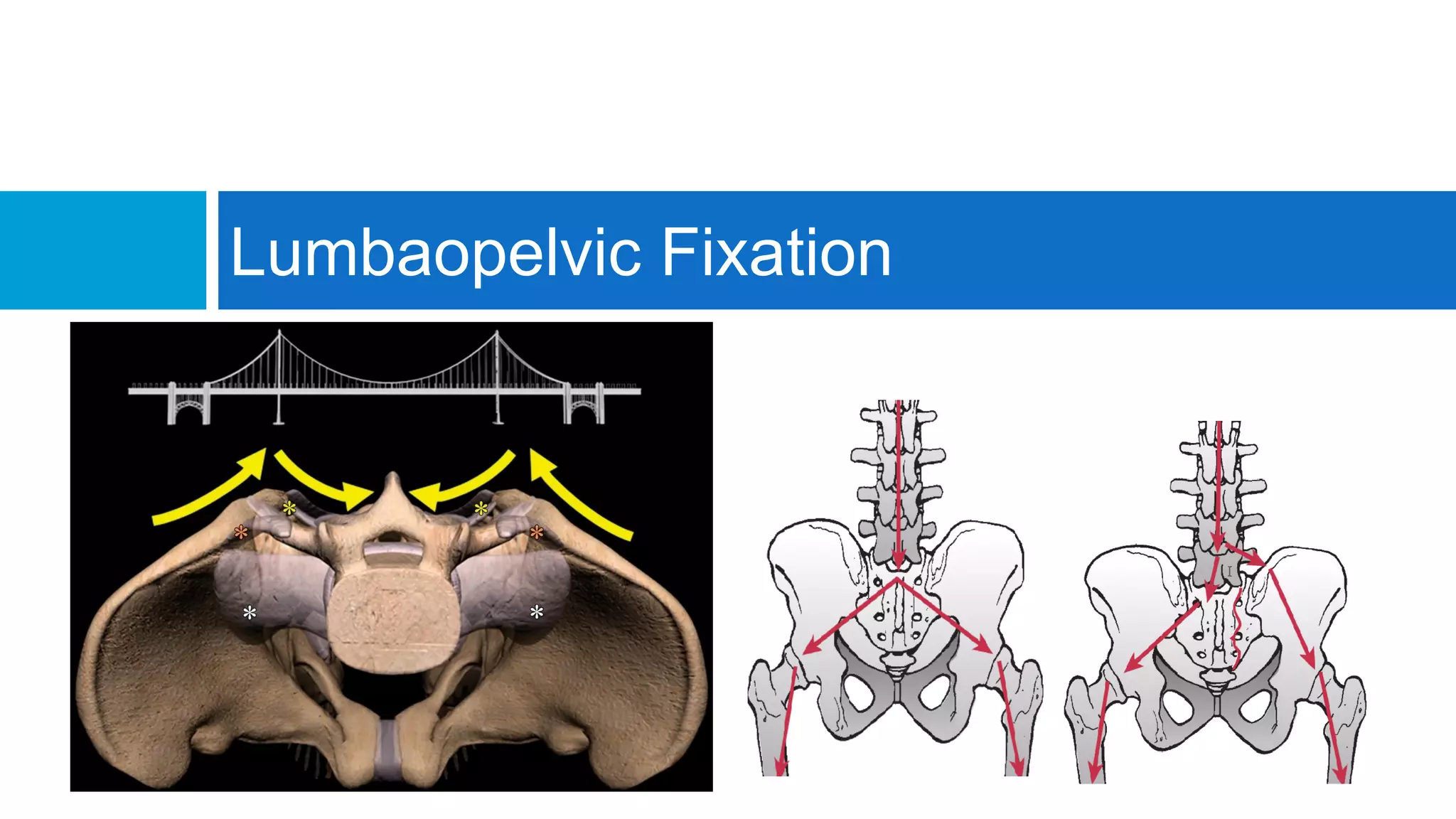 Posterior pelvic ring injury | PPT