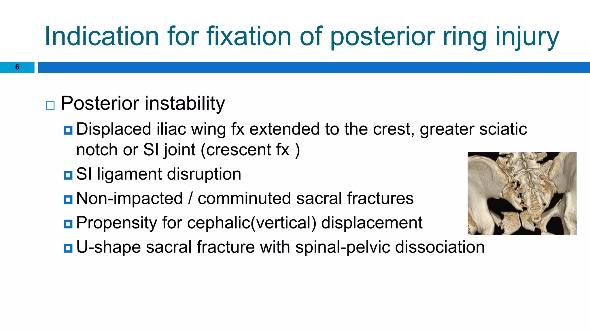 Posterior pelvic ring injury | PPT