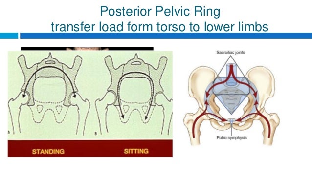 Posterior pelvic ring injury
