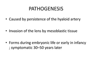 Posterior polar cataract | PPTX