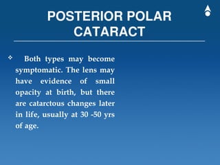 Posterior Polar Cataract PPC in the posterior cortex | PPT