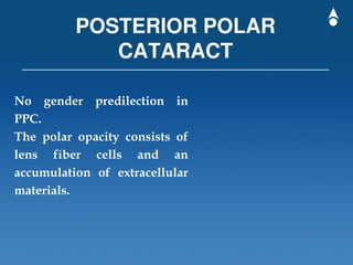 Posterior Polar Cataract PPC in the posterior cortex | PPT