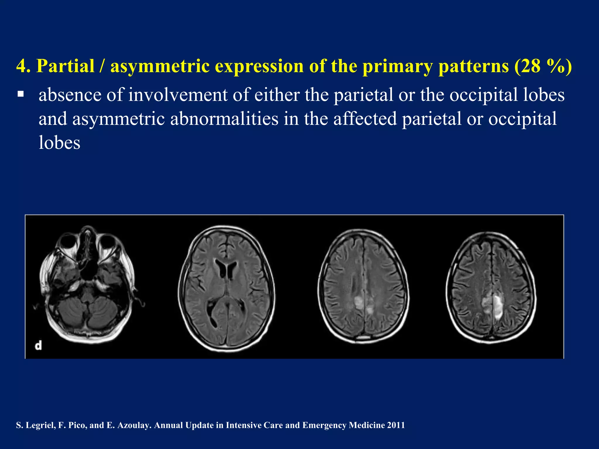 Posterior reversible encephalopathy syndrome | PPTX