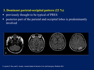 Posterior reversible encephalopathy syndrome | PPTX
