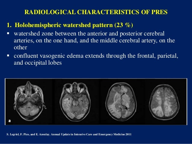 Posterior reversible encephalopathy syndrome