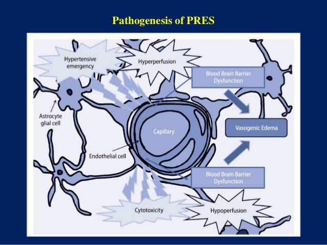 Posterior reversible encephalopathy syndrome