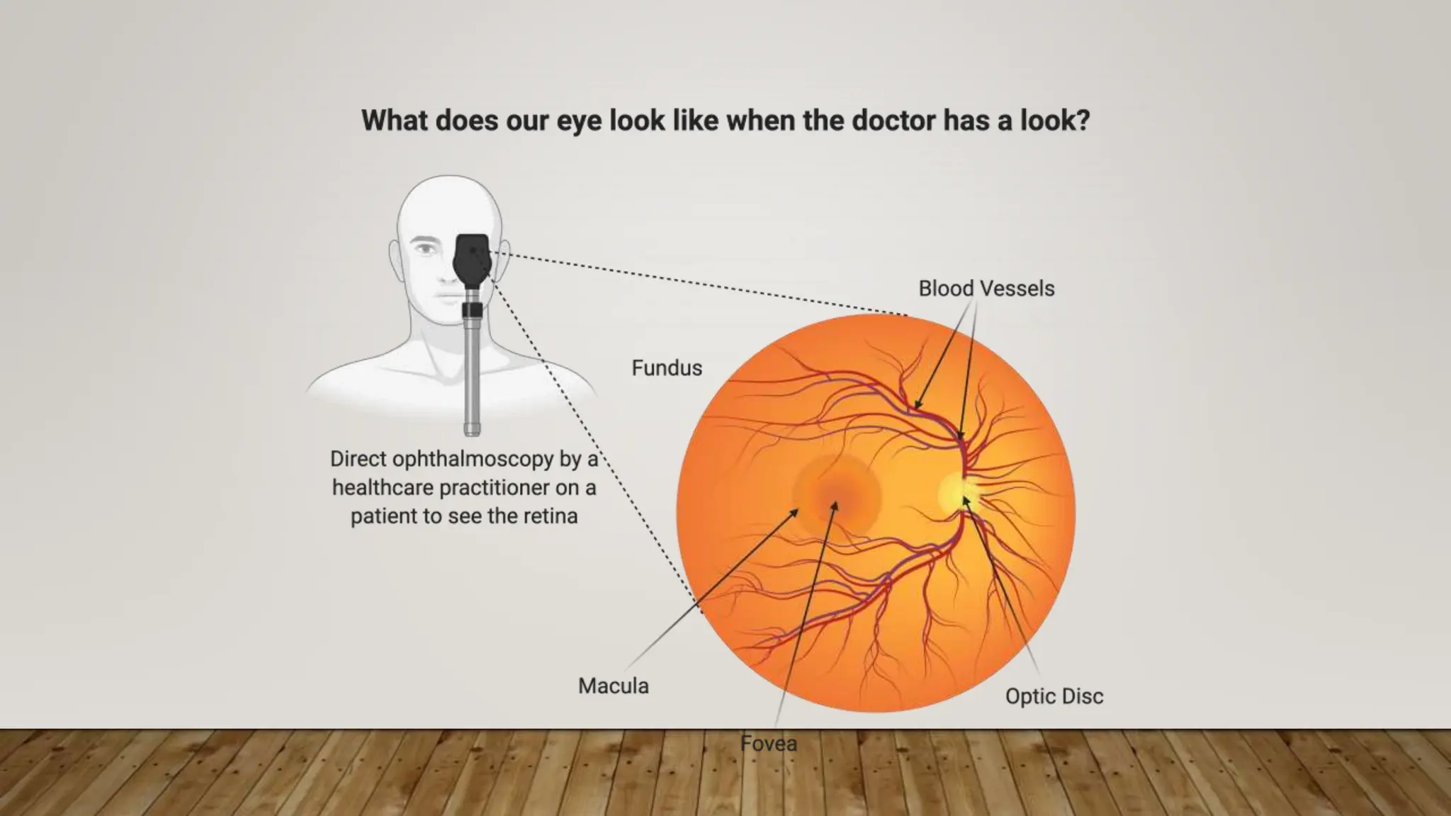 POSTERIOR SEGMENT EXAMINATION OF EYE.pptx